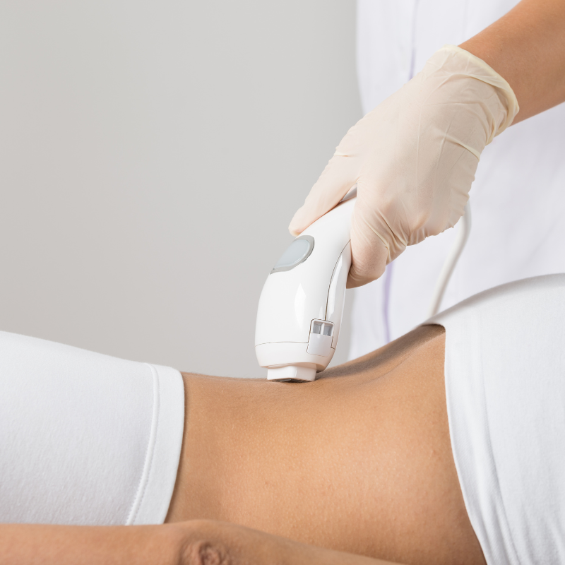 Lower Back Laser Hair Removal - Women – Modern Beauty Bar